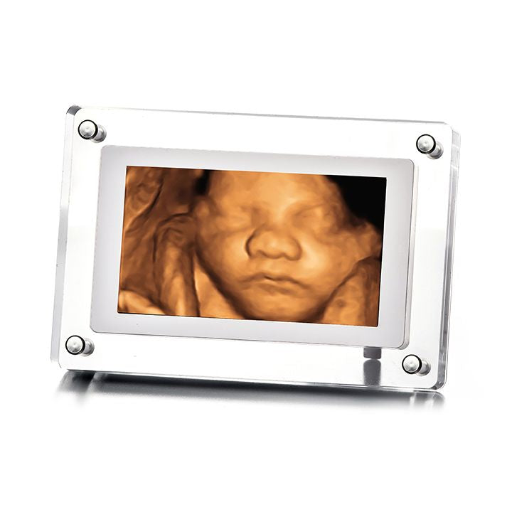 Digital Video Frame - My Baby's Heartbeat Bear